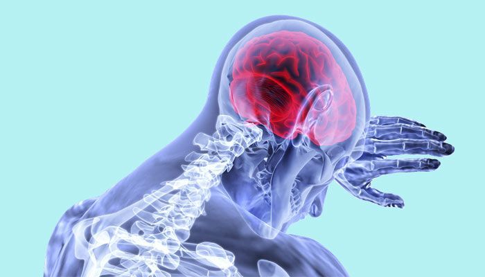 Ataque neurológico transitorio: síntomas y diferencias con la ...