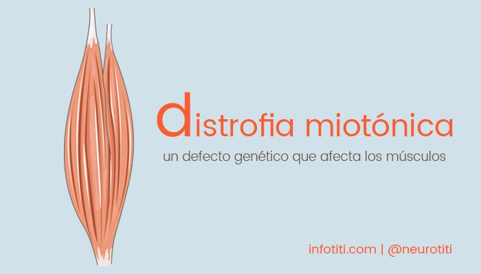 Distrofia miotónica: causas, tipos, síntomas y diagnóstico