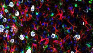 Microglía, sus funciones dentro del sistema neuroinmune