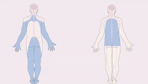 Neuralgia y neuritis: principales características y diferencias ...